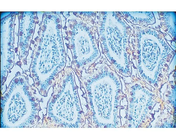 Jacalin, Biotinylated | Vector Labs