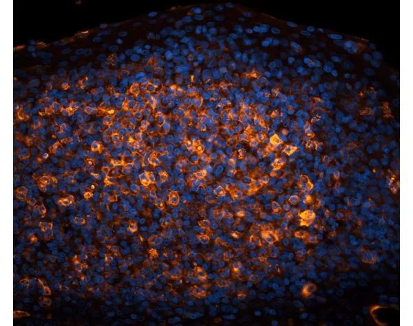 Peanut Agglutinin (PNA), CY3 | Vector Labs