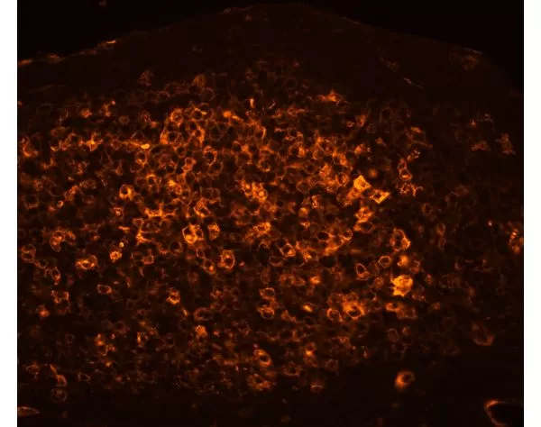 Peanut Agglutinin (PNA), CY3 | Vector Labs