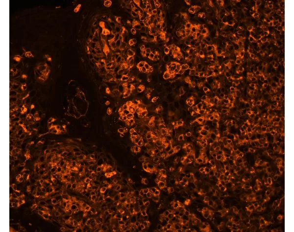 Sambucus Nigra Lectin (SNA, EBL), CY3 | Vector Labs