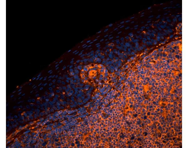 Sambucus Nigra Lectin (SNA, EBL), CY3 | Vector Labs