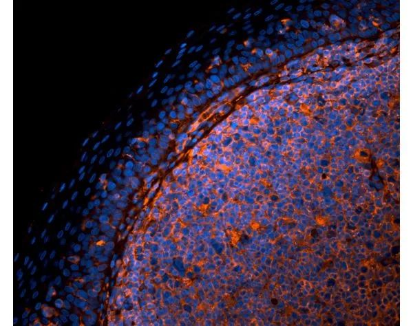 Sambucus Nigra Lectin (SNA, EBL), CY3 | Vector Labs