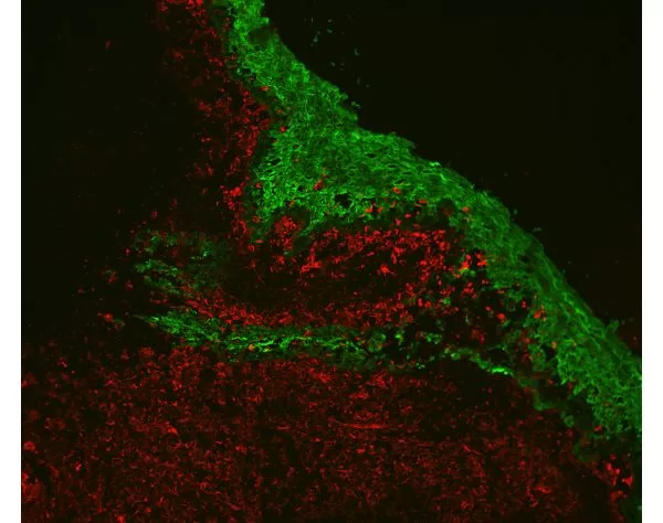 VectaFluor Duet Immunofluorescence Double Labeling Kit, DyLight 594 ...