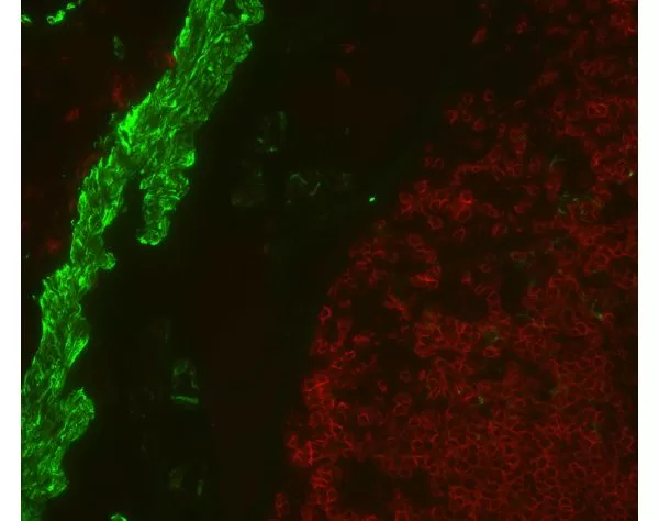 VectaFluor Duet Immunofluorescence Double Labeling Kit, DyLight 594 ...