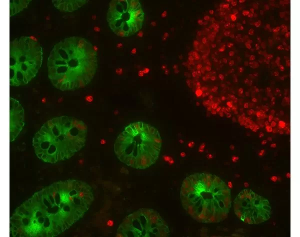 VectaFluor Duet Immunofluorescence Double Labeling Kit, DyLight 594 ...