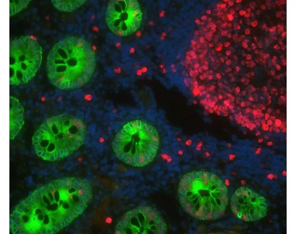 VectaFluor Duet Immunofluorescence Double Labeling Kit, DyLight 594 ...