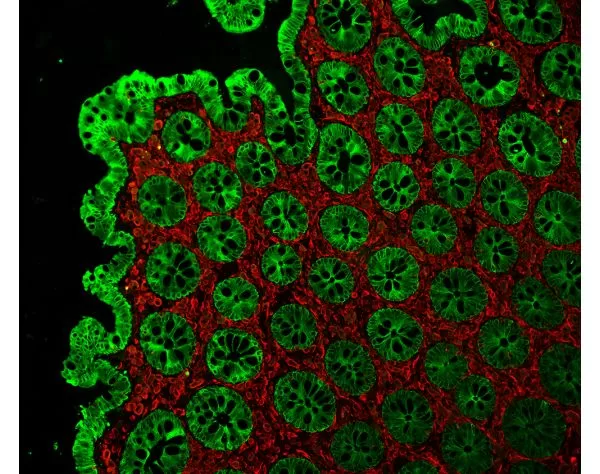 VectaFluor Duet Immunofluorescence Double Labeling Kit, DyLight 594 ...