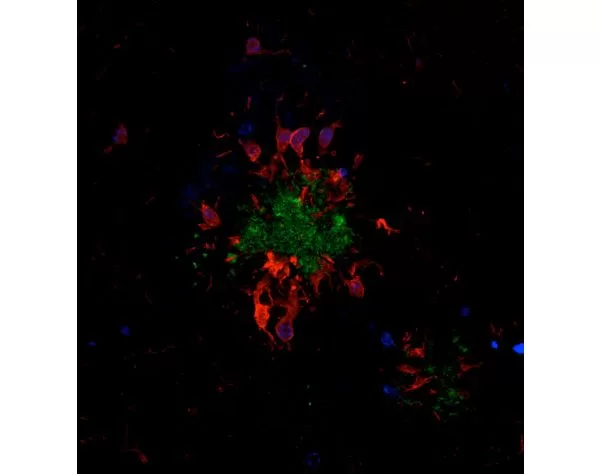 VECTASHIELD HardSet Antifade Mounting Medium | Vector Labs