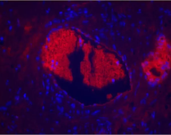 VECTASHIELD HardSet Antifade Mounting Medium With DAPI | Vector Labs