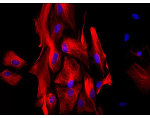 VECTASHIELD HardSet Antifade Mounting Medium With DAPI | Vector Labs