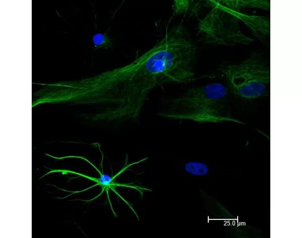 VECTASHIELD HardSet Antifade Mounting Medium With DAPI | Vector Labs