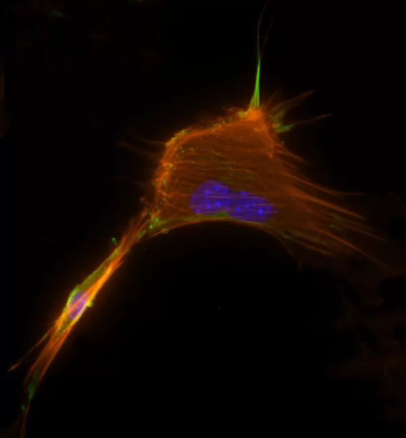 VECTASHIELD HardSet Antifade Mounting Medium With Phalloidin | Vector Labs