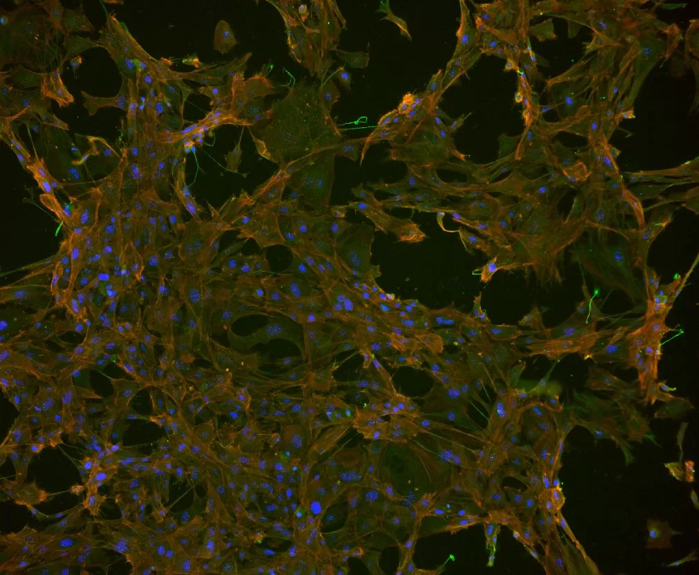 VECTASHIELD HardSet Antifade Mounting Medium With Phalloidin | Vector Labs