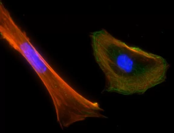 VECTASHIELD HardSet Antifade Mounting Medium With Phalloidin | Vector Labs