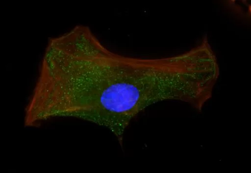 VECTASHIELD HardSet Antifade Mounting Medium With Phalloidin | Vector Labs