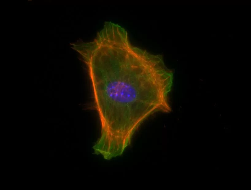 VECTASHIELD HardSet Antifade Mounting Medium With Phalloidin | Vector Labs