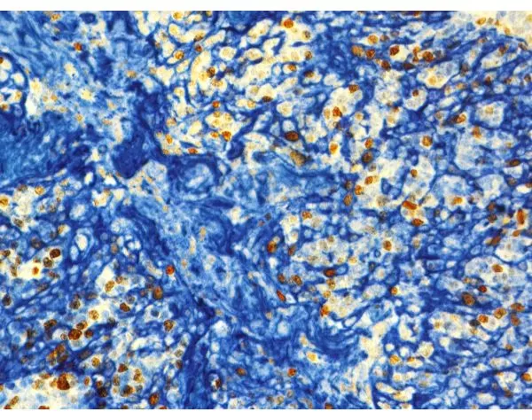 VectaMount® Express Mounting Medium | Vector Labs