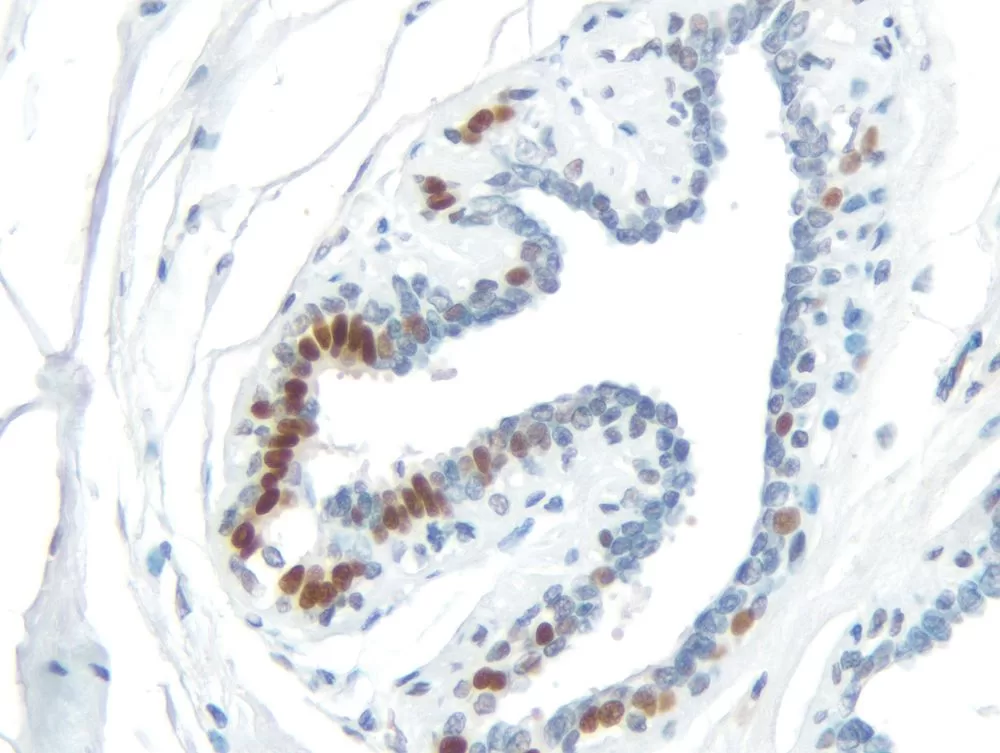 DAB Substrate Kit, Peroxidase (HRP), With Nickel, (3,3 ...