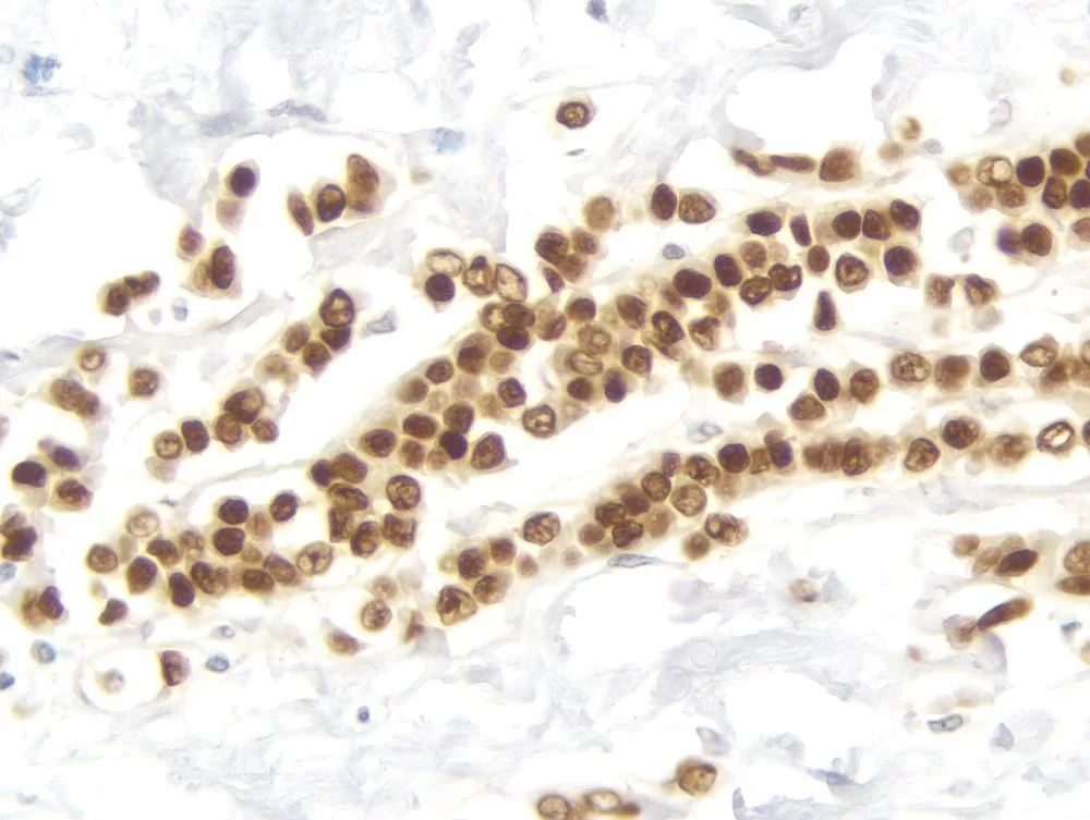 DAB Substrate Kit, Peroxidase (HRP), With Nickel, (3,3 ...