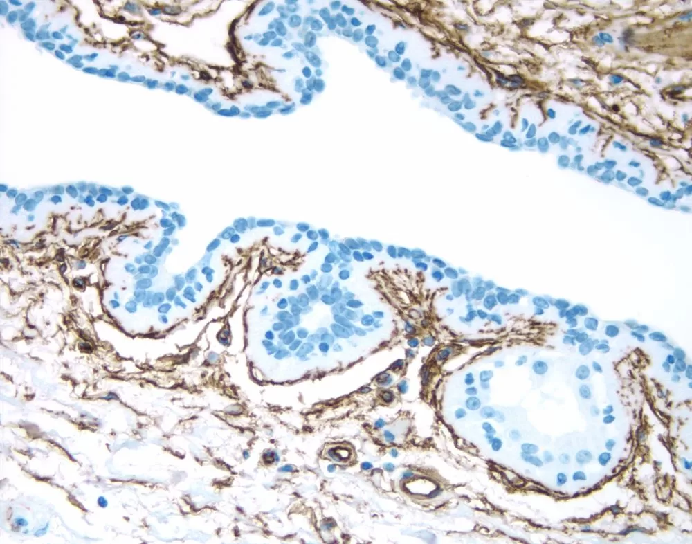 DAB Substrate Kit, Peroxidase (HRP), With Nickel, (3,3 ...