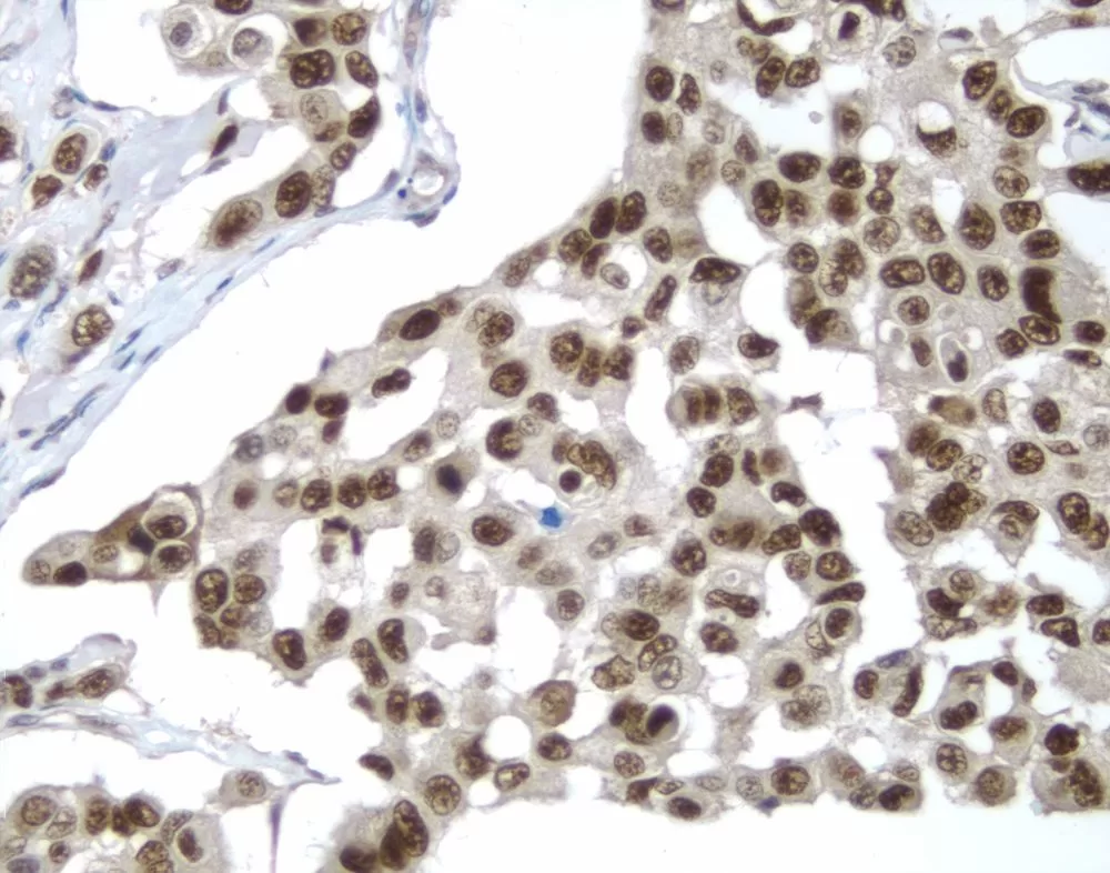 DAB Substrate Kit, Peroxidase (HRP), With Nickel, (3,3 ...