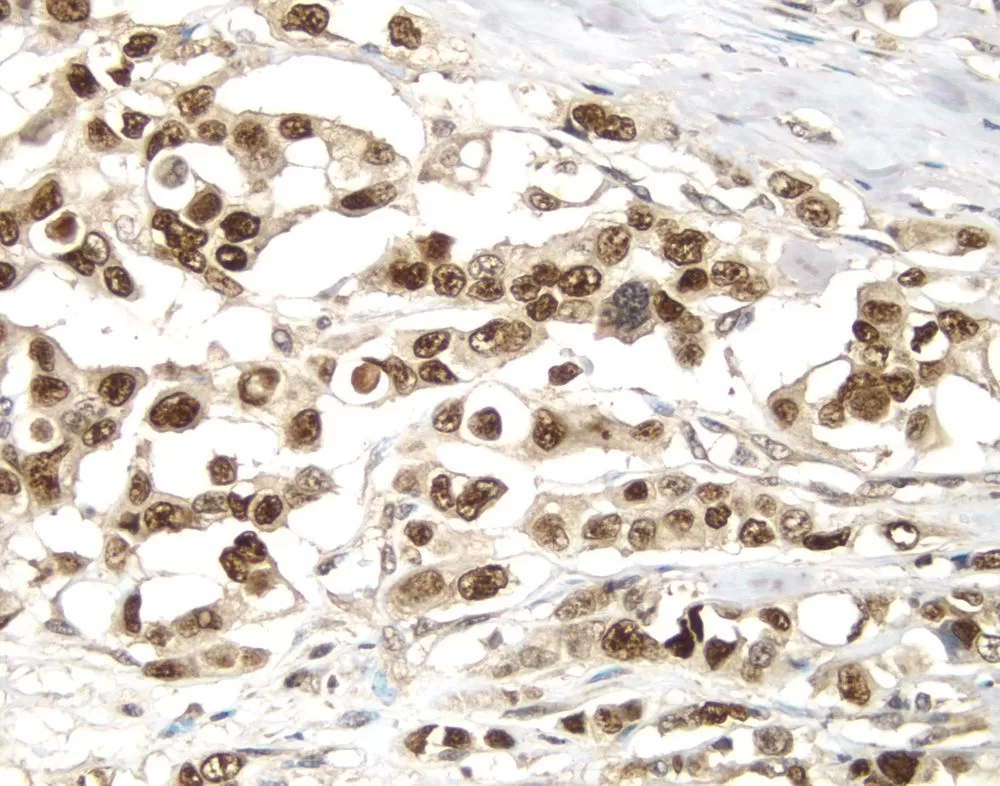 DAB Substrate Kit, Peroxidase (HRP), With Nickel, (3,3 ...