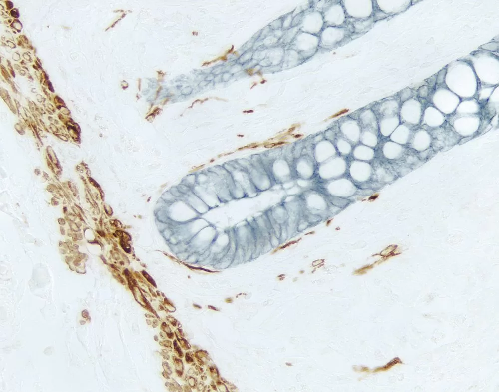 DAB Substrate Kit, Peroxidase (HRP), With Nickel, (3,3 ...