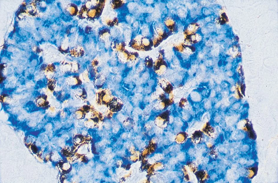 DAB Substrate Kit, Peroxidase (HRP), With Nickel, (3,3 ...