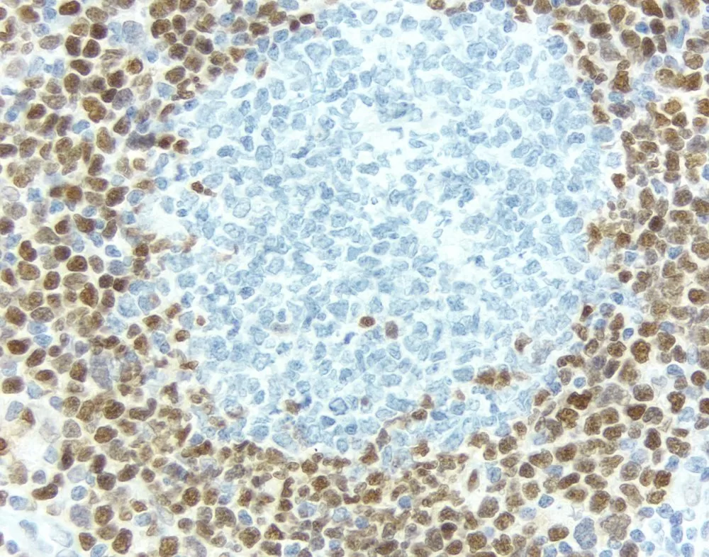 DAB Substrate Kit, Peroxidase (HRP), With Nickel, (3,3 ...