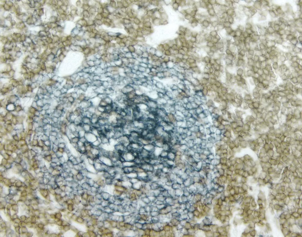 DAB Substrate Kit, Peroxidase (HRP), With Nickel, (3,3 ...