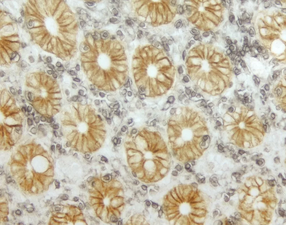 DAB Substrate Kit, Peroxidase (HRP), With Nickel, (3,3 ...