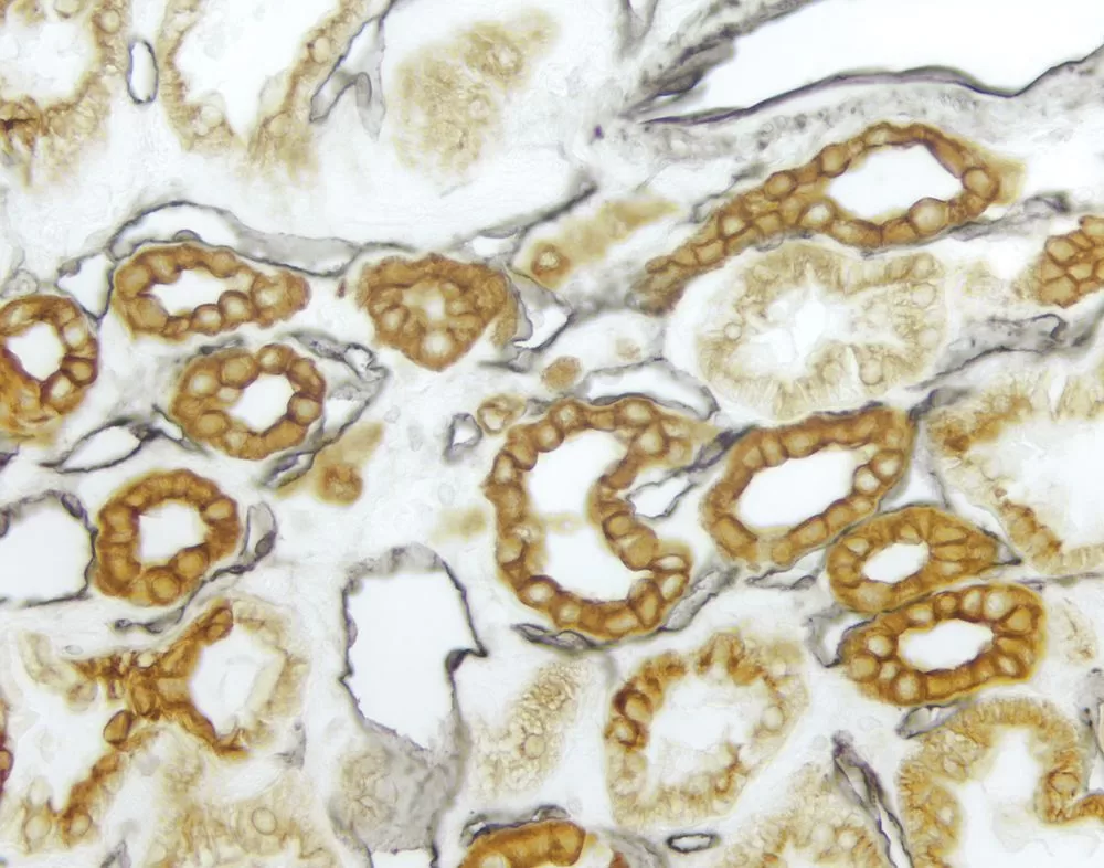 DAB Substrate Kit, Peroxidase (HRP), With Nickel, (3,3 ...