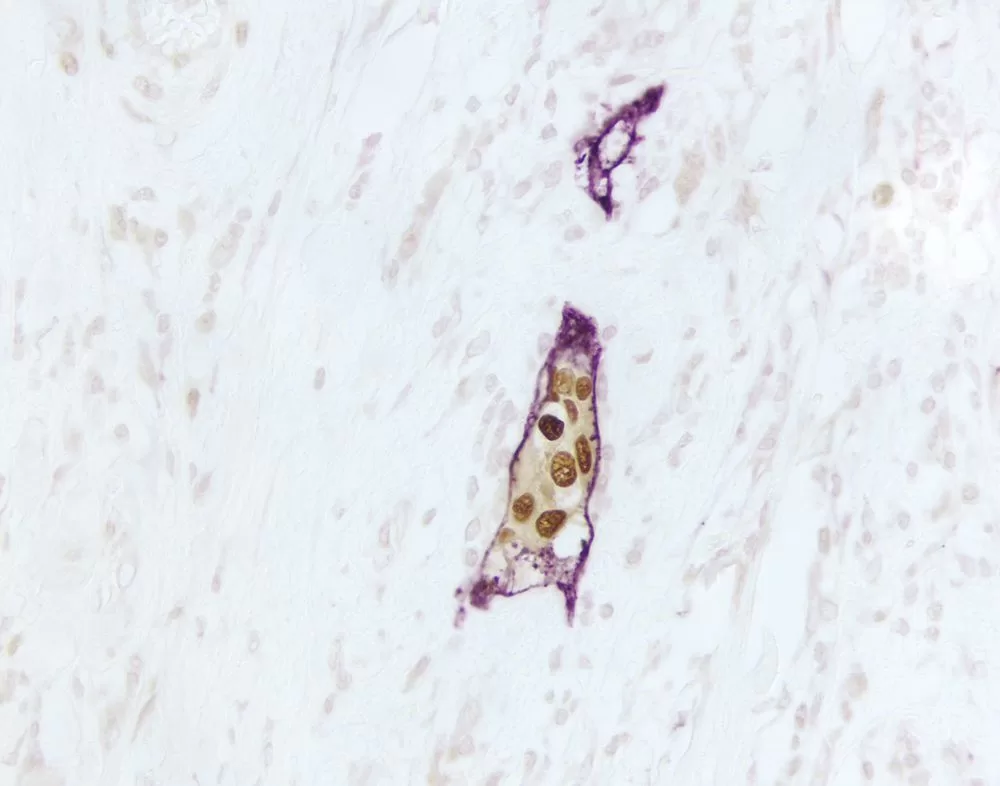 DAB Substrate Kit, Peroxidase (HRP), With Nickel, (3,3 ...