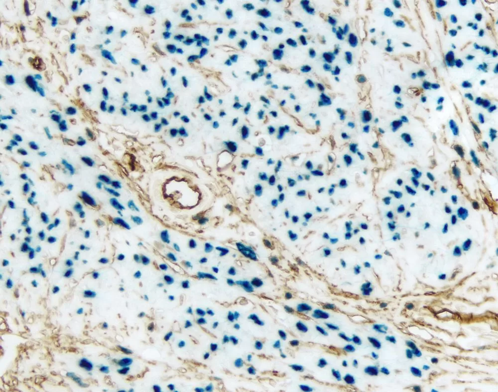 DAB Substrate Kit, Peroxidase (HRP), With Nickel, (3,3 ...