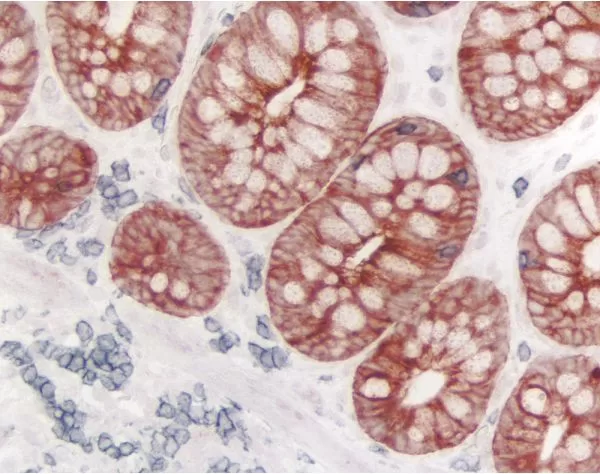 ImmPACT® AMEC Red Substrate, Peroxidase (HRP) | Vector Labs