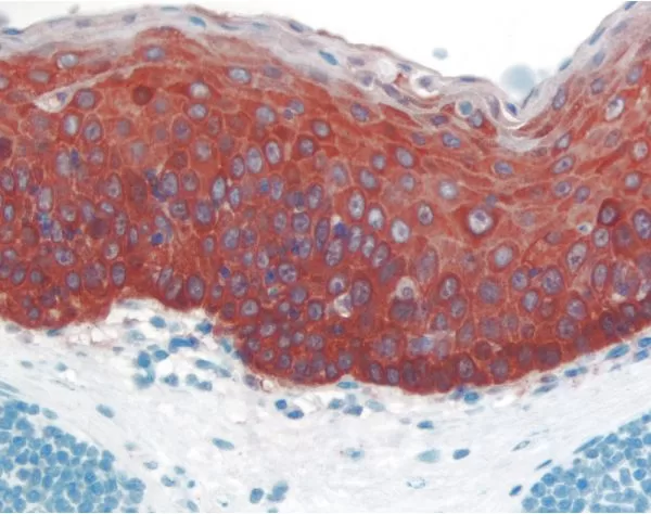 ImmPACT® AMEC Red Substrate, Peroxidase (HRP) | Vector Labs