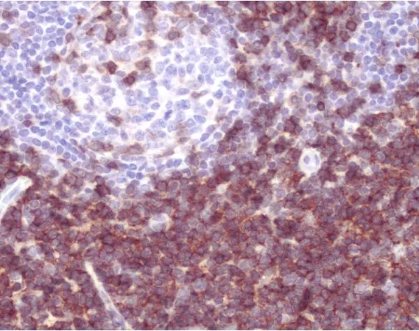 Vector NovaRED Substrate Kit, Peroxidase (HRP) | Vector Labs