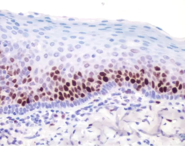 Vector NovaRED Substrate Kit, Peroxidase (HRP) | Vector Labs