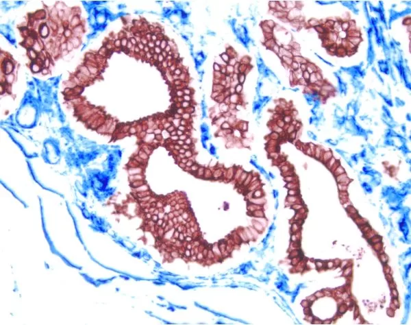 Vector NovaRED Substrate Kit, Peroxidase (HRP) | Vector Labs