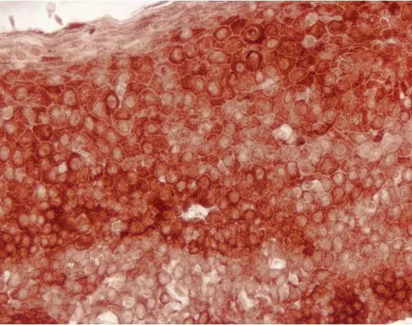 Vector NovaRED Substrate Kit, Peroxidase (HRP) | Vector Labs