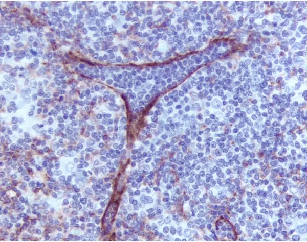 Vector NovaRED Substrate Kit, Peroxidase (HRP) | Vector Labs