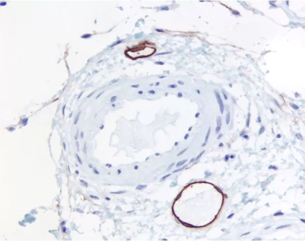 Vector NovaRED Substrate Kit, Peroxidase (HRP) | Vector Labs
