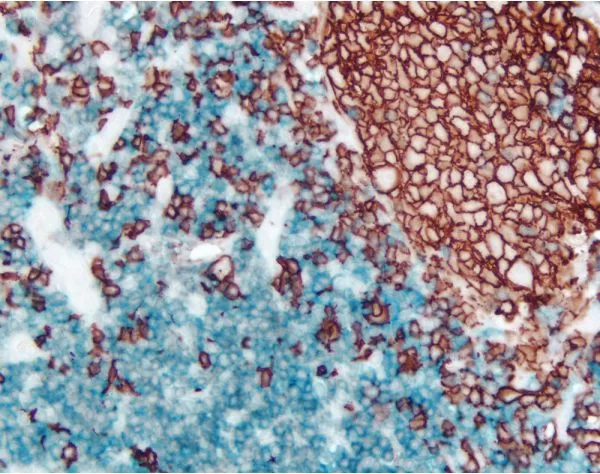 Vector NovaRED Substrate Kit, Peroxidase (HRP) | Vector Labs