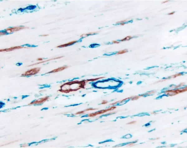 Vector NovaRED Substrate Kit, Peroxidase (HRP) | Vector Labs