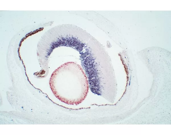 Vector NovaRED Substrate Kit, Peroxidase (HRP) | Vector Labs