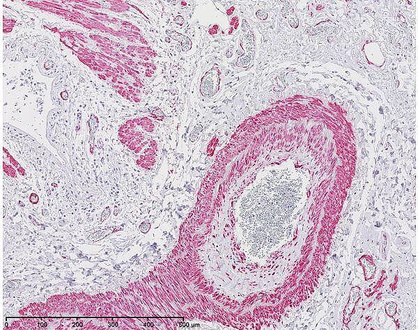 ImmPACT Vector Red Substrate, Alkaline Phosphatase (AP) | Vector Labs