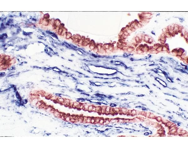 BCIP/NBT Substrate Kit, Alkaline Phosphatase (AP), (5-bromo-4-chloro-3 ...